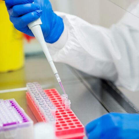 Neutralizing Assays and Viral ELISA | Assess viral neutralization and ...